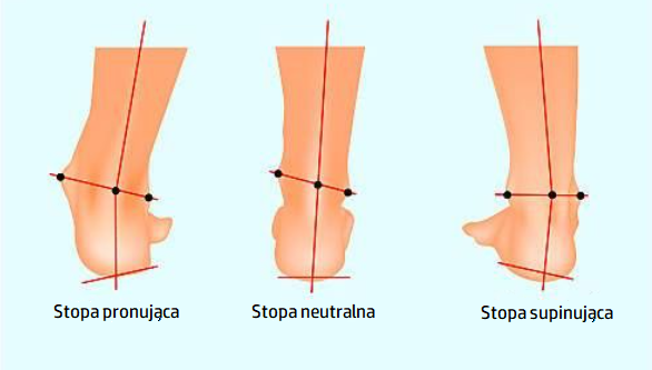Supinacja stopy i nadmierna supinacja — jak zapobiegać bólom stóp i ...